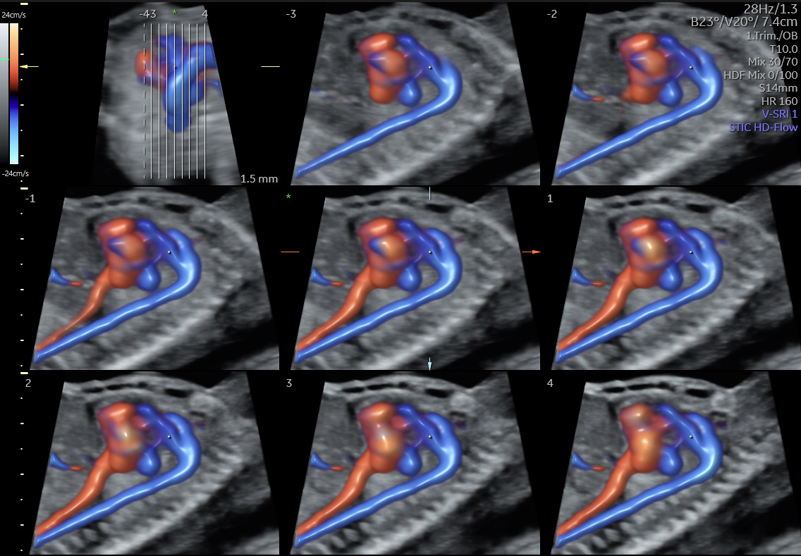 上準科技股份有限公司-產品介紹